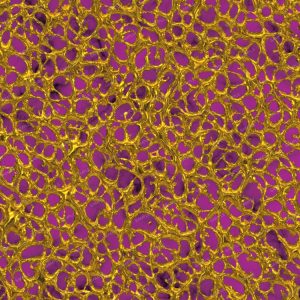 Royal Golden Matrix – Pattern Crew