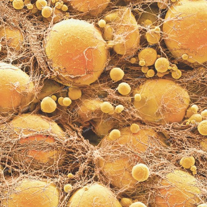 Fat Cells – Pattern Crew